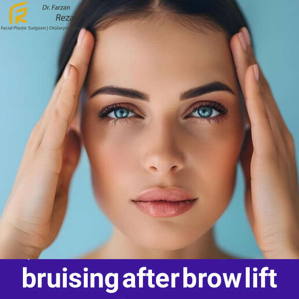 tips you should follow to reduce bruising after eyebrow lift